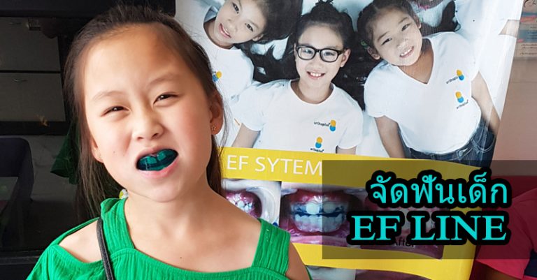 รีวิวแชร์ประสบการณ์จัดฟันเด็กเล็กด้วย EF LINE ได้ผลแค่ไหน ราคาเท่าไหร่ มาดูกัน | 2Madames.com ...