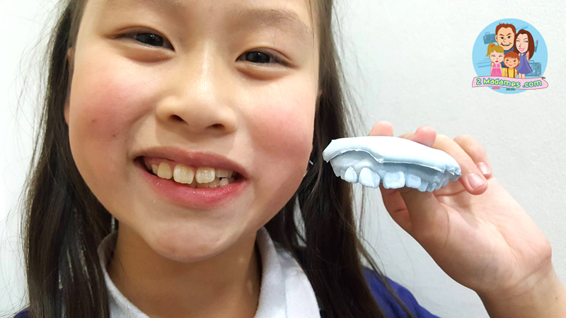 รีวิวแชร์ประสบการณ์จัดฟันเด็กเล็กด้วย EF LINE ได้ผลแค่ไหน ราคาเท่าไหร่ ...